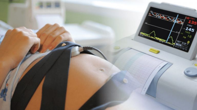 Diplomado en Monitoreo Electrónico Fetal (NST) - Insimed
